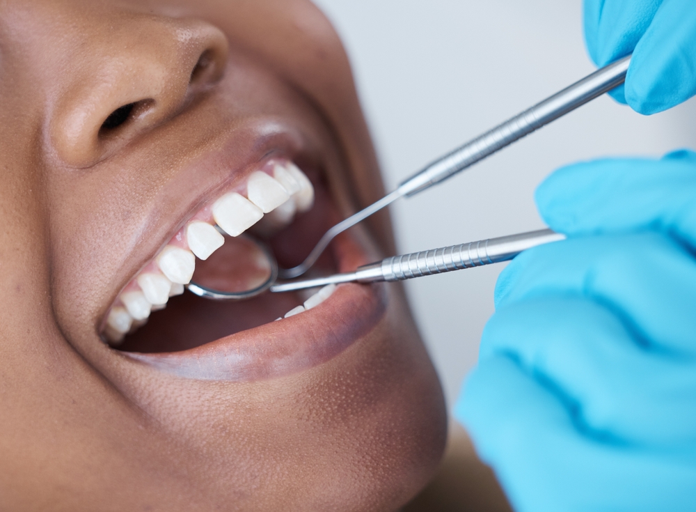 The Importance of Teeth Cleaning Every Three Months